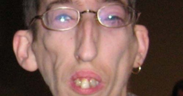 Site bizarro elege os homens mais feios do mundo! - Fotos - R7 Hora 7