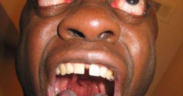 Site bizarro elege os homens mais feios do mundo! - Fotos - R7 Hora 7