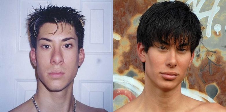 Justin Jedlica Antes E Depois Human Ken Doll Reveals Reason Behind