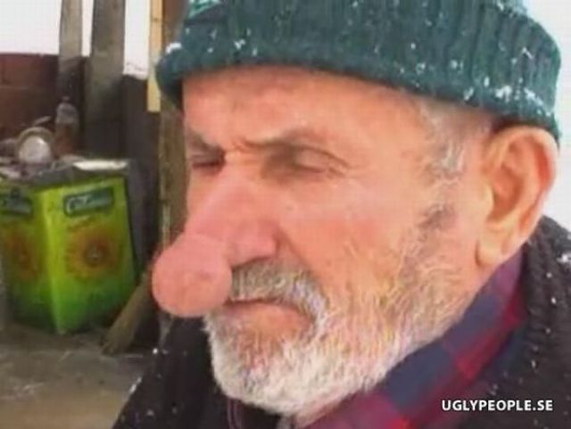 Site bizarro elege as pessoas mais feias do planeta - Fotos - R7 Hora 7