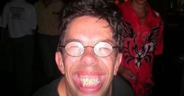 Site bizarro elege as pessoas mais feias do planeta - Fotos - R7 Hora 7