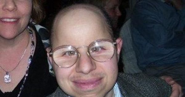 Site bizarro elege as pessoas mais feias do planeta - Fotos - R7 Hora 7