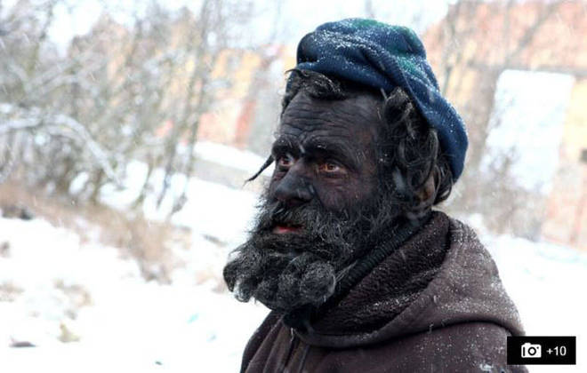 Homem mais sujo da Europa? Mendigo queima seus pertences e passa cinzas ...