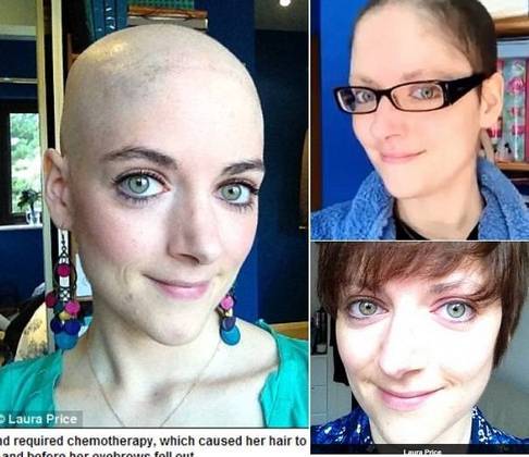 Após derrotar câncer, jovem exibe fotos para mostrar o crescimento de ...