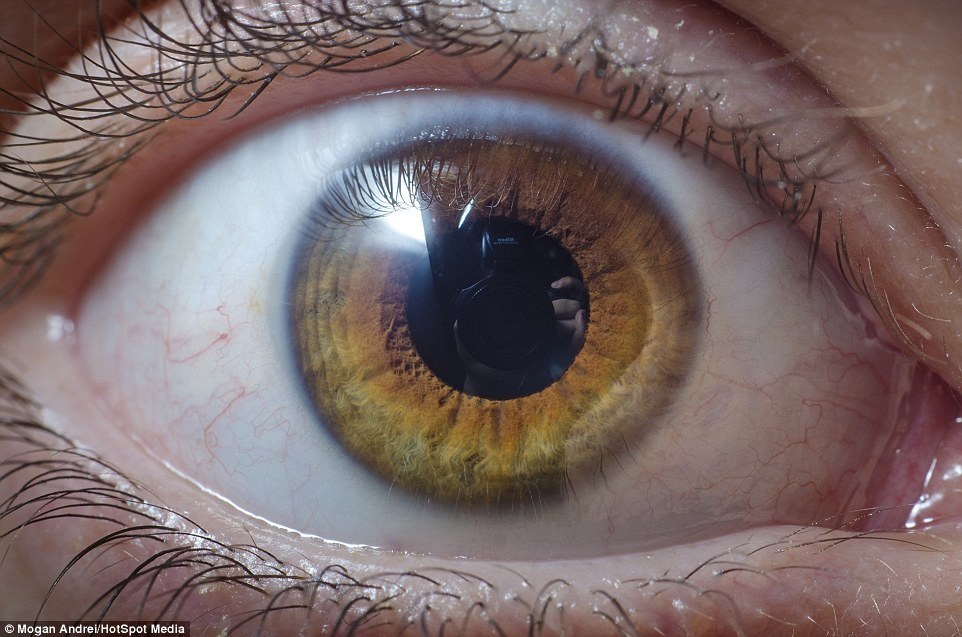 Coloridos e deslumbrantes: fotografias mostram a beleza do olho humano ...