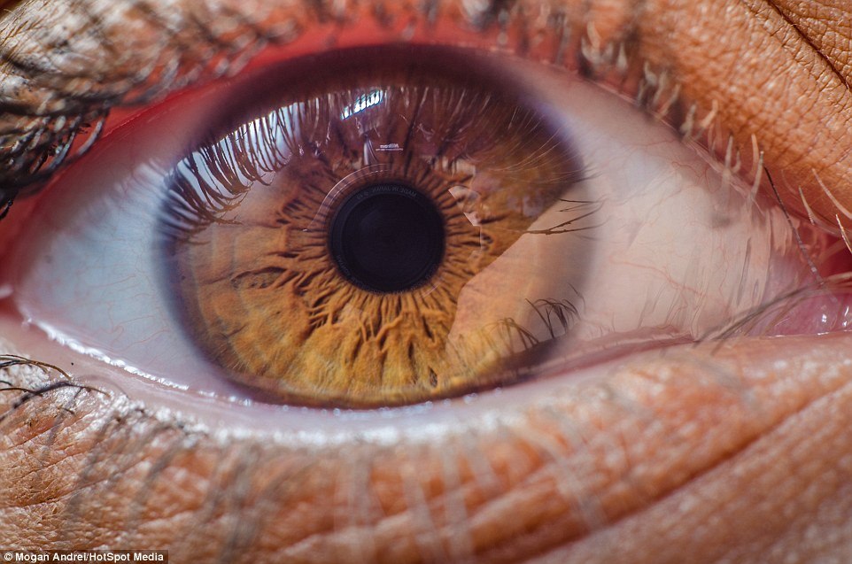 Coloridos e deslumbrantes: fotografias mostram a beleza do olho humano ...