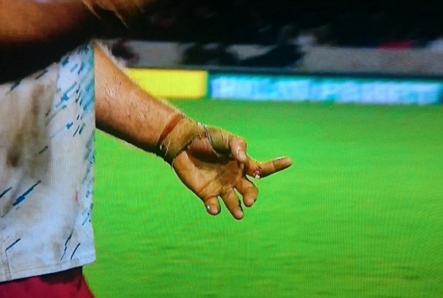 Bicampeã olímpica, Thaisa sofre lesão grave na Turquia e deixa ...