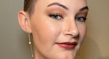 Mulher acha que joelho dói por acidente com cavalo, mas descobre um ...