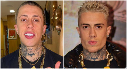 MC Daniel assume procedimentos estéticos no rosto: 'Realmente, estou ...