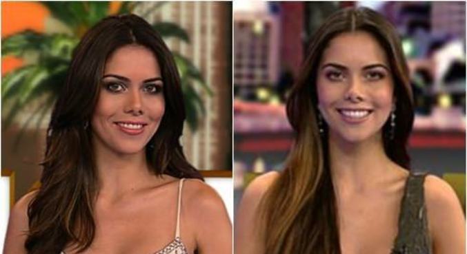 Sete famosos que, como Mariano, mudaram o nariz várias vezes! - Prisma - R7 Keila Jimenez