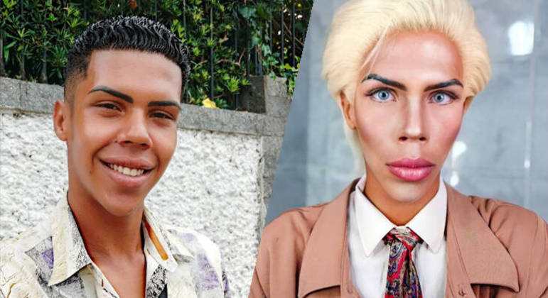 Conheça mais sobre Toco, o “homem-cachorro” japonês - Lifestyle - R7 Flipar