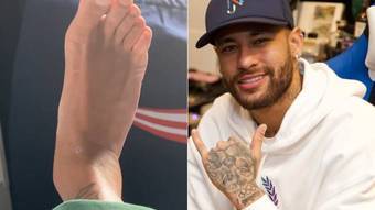 Neymar posta pé recuperado e usa música para dar indireta: 'Pessoas ...