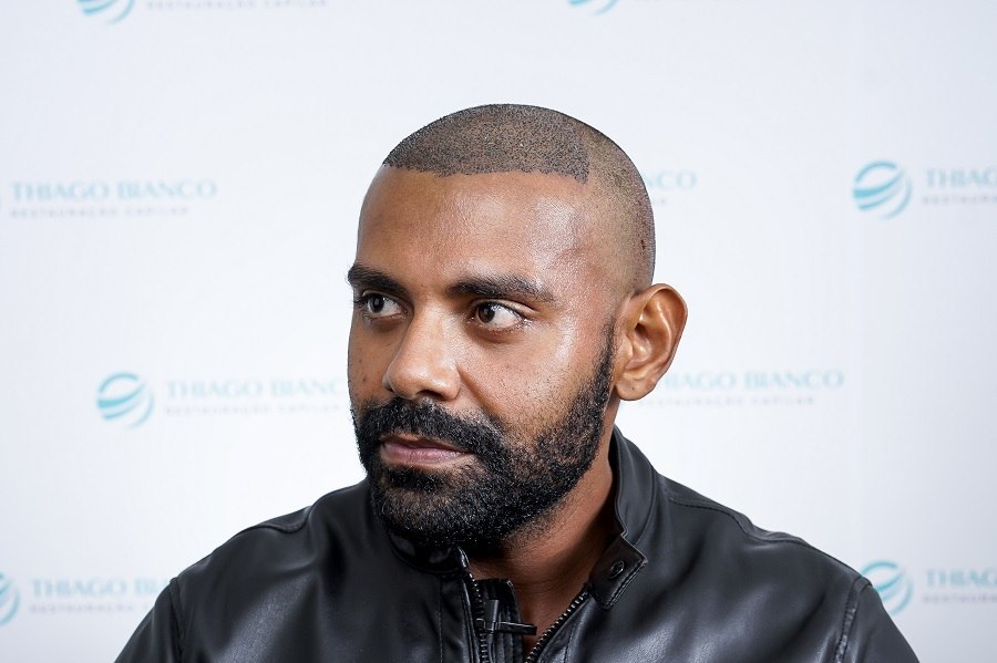 Pablo faz cirurgia de transplante capilar e exibe resultado ...