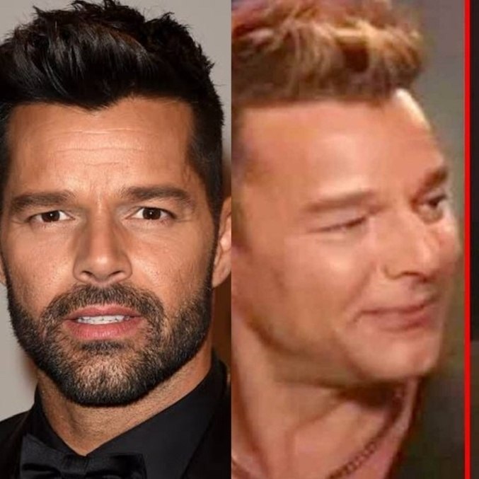 Afinal, o que aconteceu com o rosto de Ricky Martin? - Prisma - R7 ...