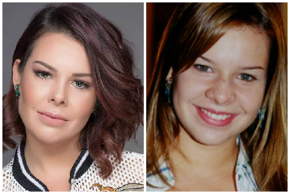 Saiba mais sobre o procedimento estético que pode levar a necrose de ...