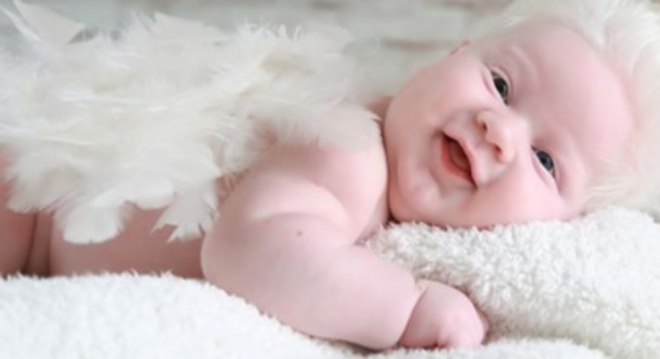 Entenda a síndrome do 'bebê platinado’ que encantou a web - Notícias ...