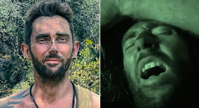 Participante de reality show queima a região íntima ao dormir muito ...