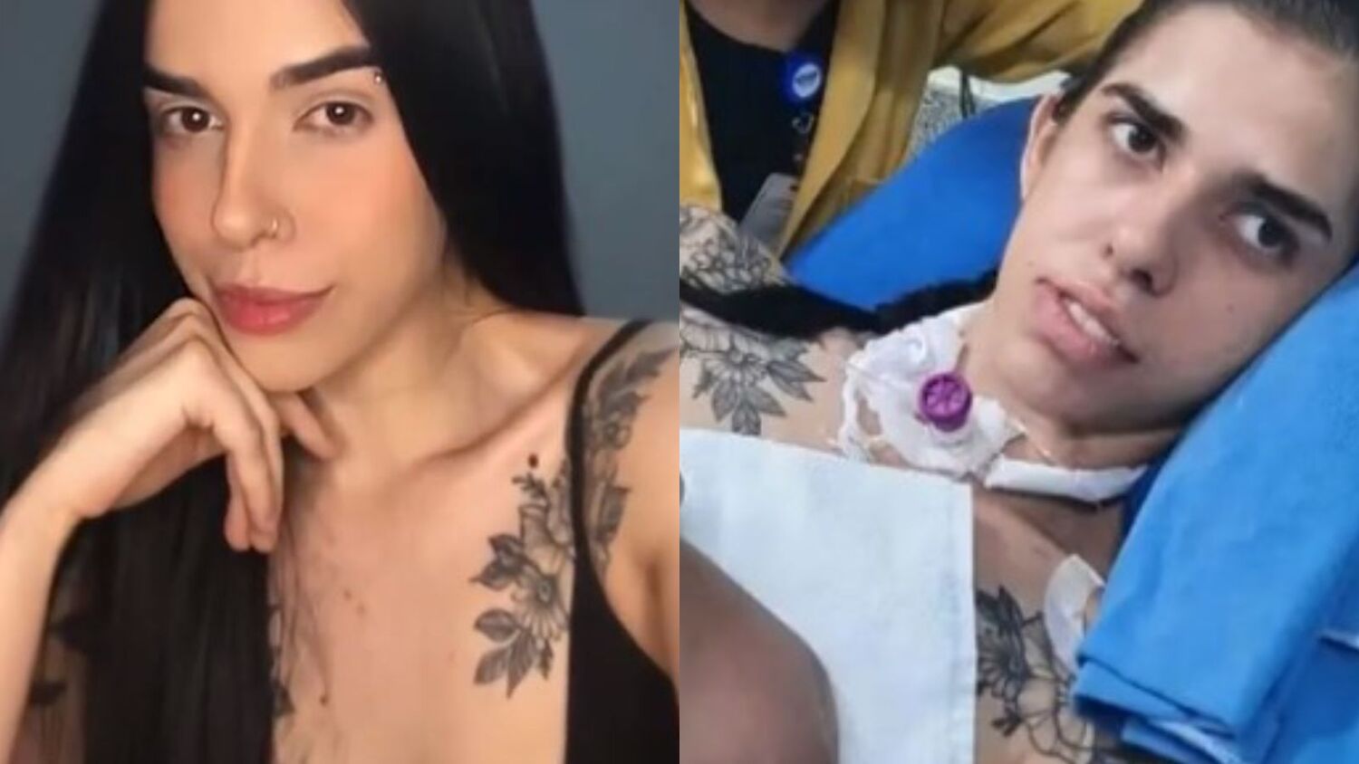 Jovem Que Cheirou Pimenta Recebe Alta Após Cinco Meses Internada